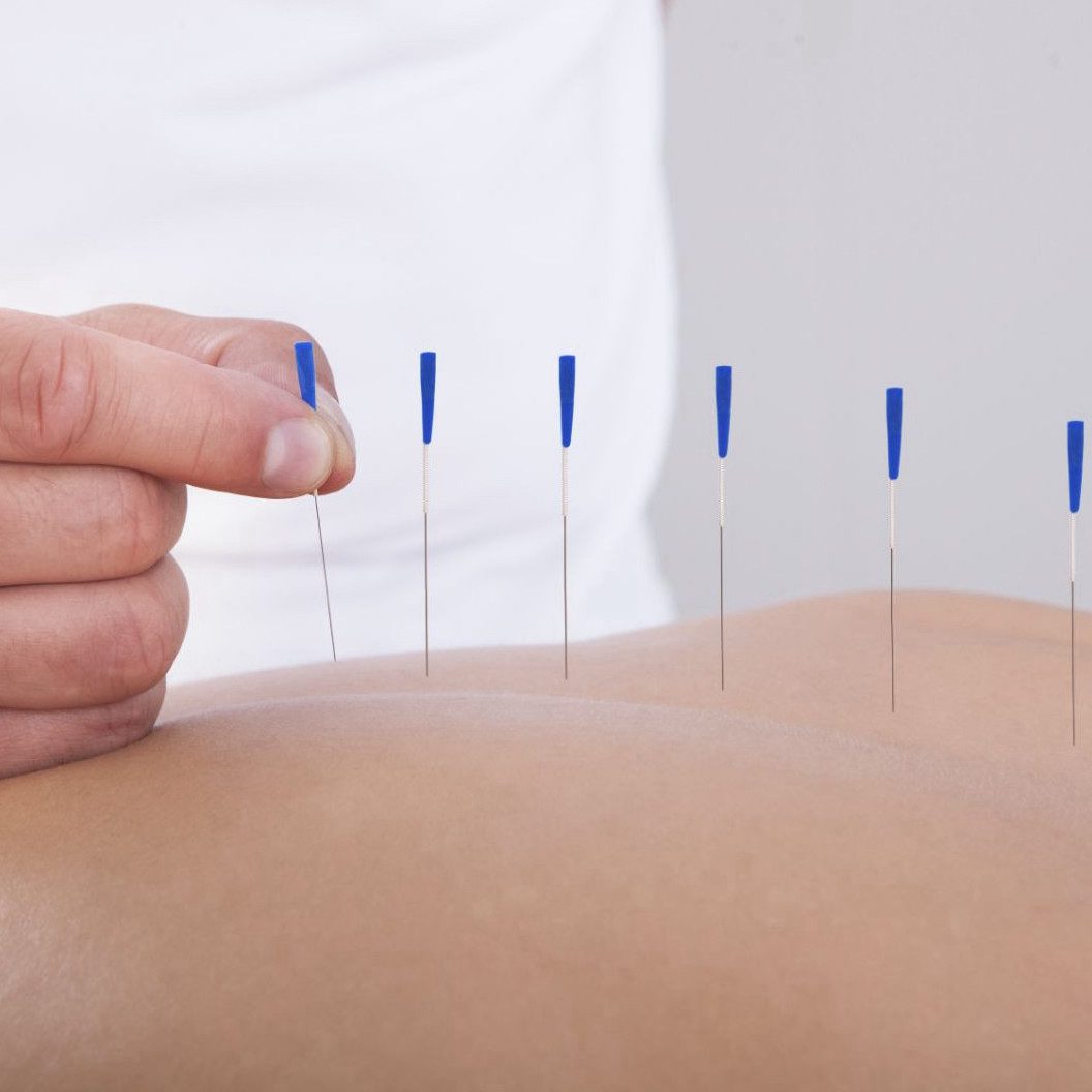 How to Build an Acupuncture Marketing Plan for 2025