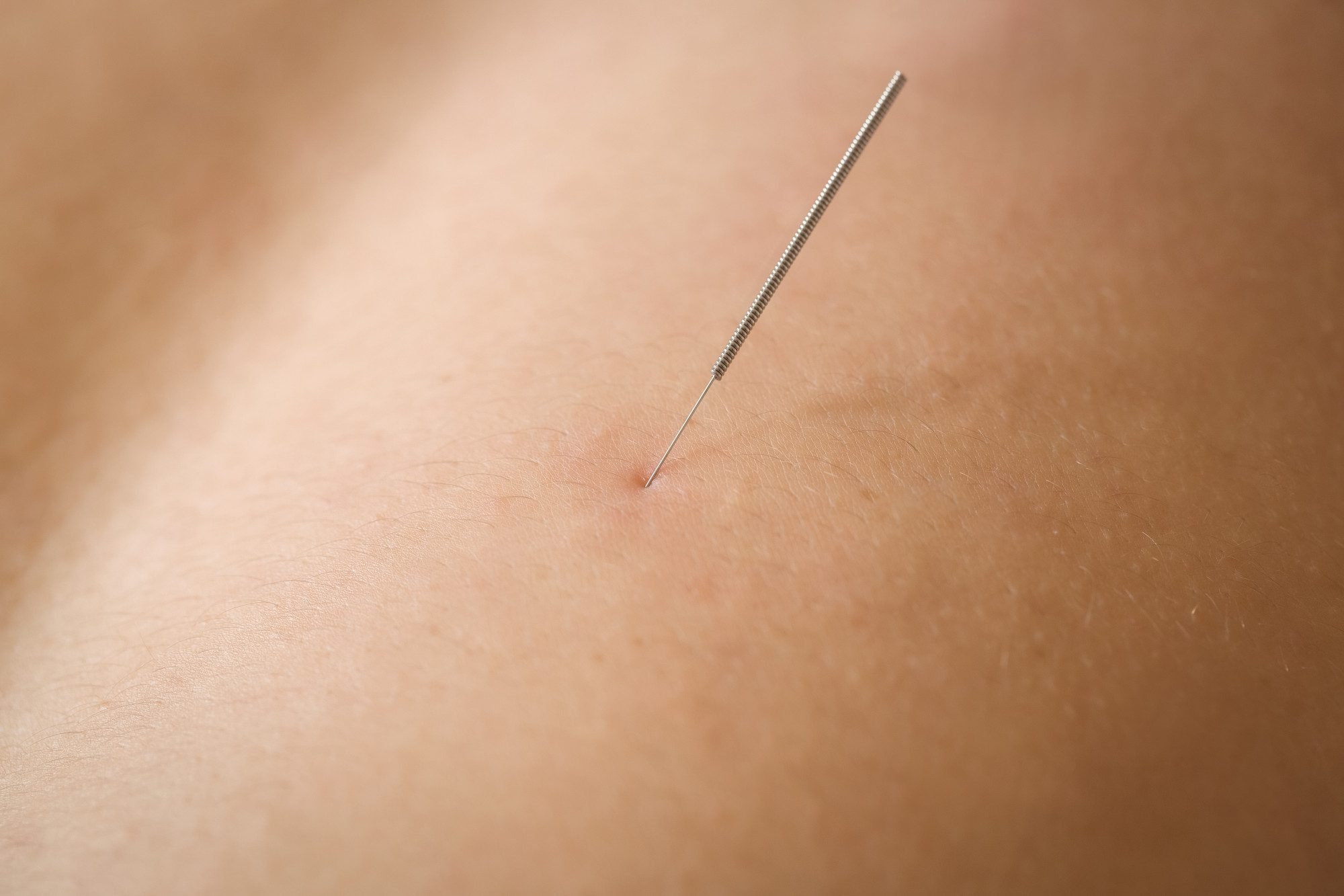 7 Must-Have Features for an Effective Acupuncture Website